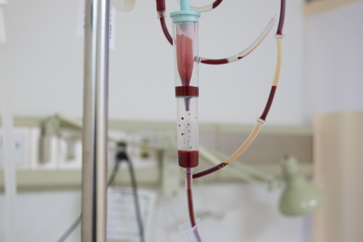 Study highlights lack of standardization in intrauterine transfusions