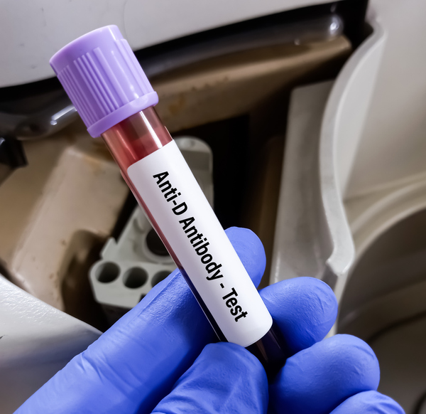 Researchers update guidelines for red blood cell monitoring in HDFN